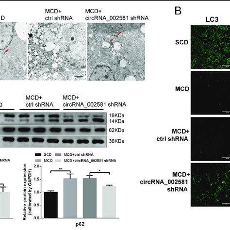 Effect Of Antagonizing Circrna002581 On Autophagy In Mcd Induced Nash