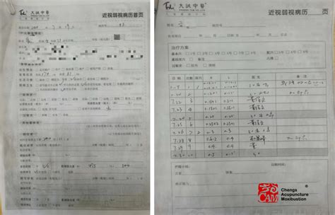 青岛大诚中医门诊部梅花针 耳穴治疗近视病例分析 针灸