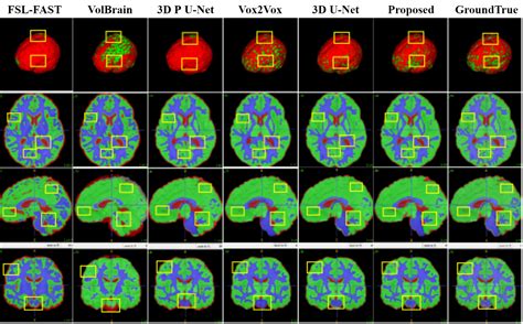 github gaffaricelik vol2seggan a new 3d mri segmentation method