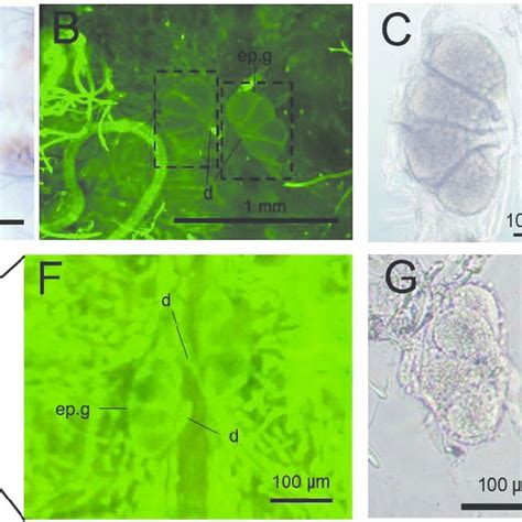 Morphological Analyses Of Testes In The First And Third Instar Larvae