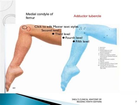 Surface Anatomy Of Lower Limb By Zkhan PPT