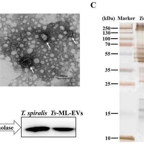 Characterization And Protein Analysis Of Ts Ml Evs A Morphological Download Scientific