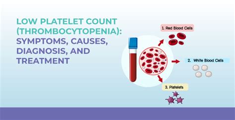 Low Platelet Count Thrombocytopenia Symptoms Causes Diagnosis And Treatment MrMed