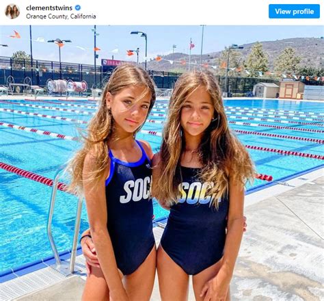 They Called Them The Worlds Most Beautiful Twins Years Ago But Now Look What The Girls