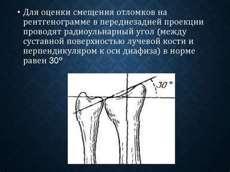 Повреждение костей предплечья Online Presentation