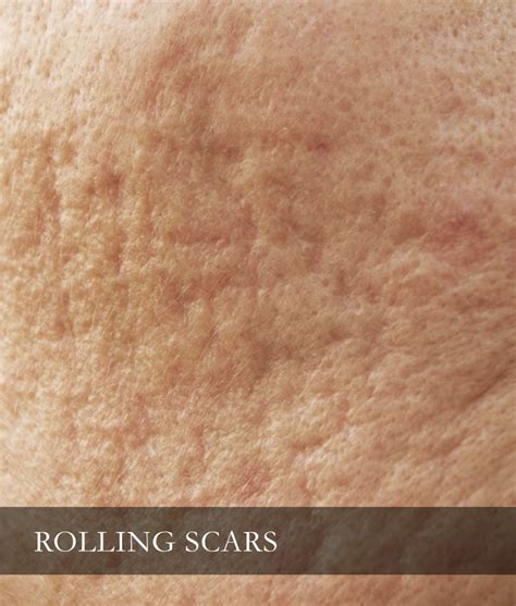 Box Scar Dr Siew Com
