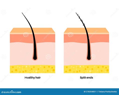 Normal Hair Structure In Scalp Skin Cross Section Icon Cartoon Vector