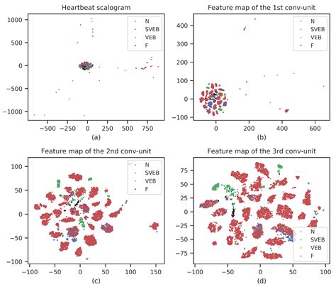 automatic ecg classification using continuous wavelet transform and