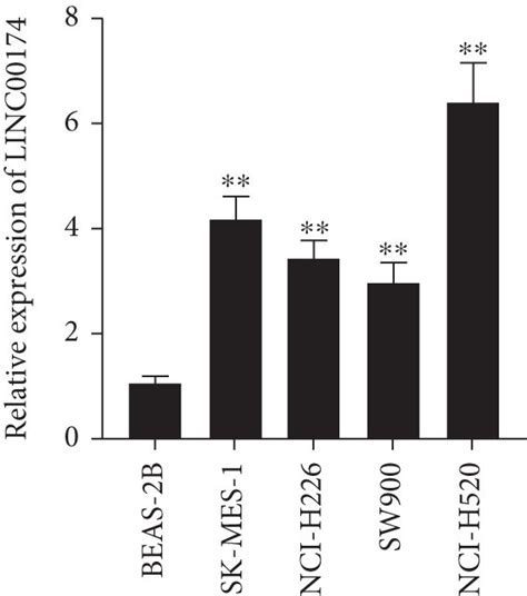 Linc00174 Depletion Suppresses The Malignant Behaviors Of Lusc Cells