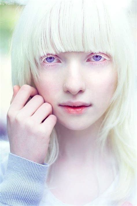 Albino Eyes Violet