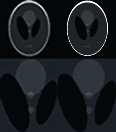 The Shepp Logan Phantom Results Comparison From The Left The