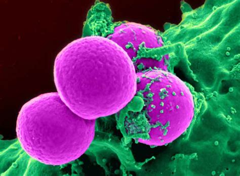 Antibiotic Options For Mrsa Bacteremia Are We Still Stuck In