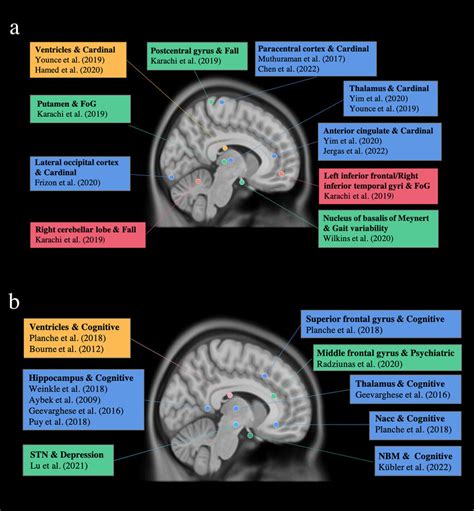 Regions Associated With Motor A And Non Motor B Outcomes Blue And Download Scientific