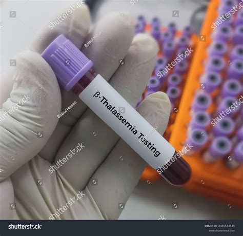 Types Liquid Chromatography Hplc 8 Images Photos De Stock Objets 3d
