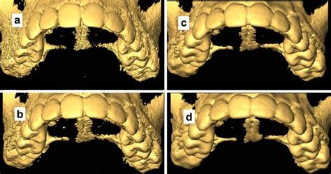 Influence Of Voxel Size Manipulation On The Quality Of The 3d Model Download Scientific Diagram