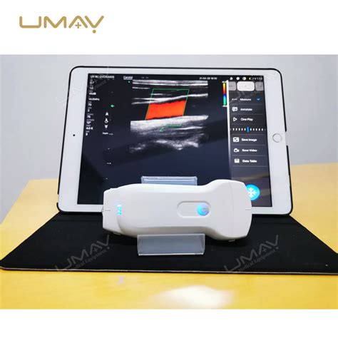 3 In 1 Portable Wireless Ultrasound With Linear And Convex Probes