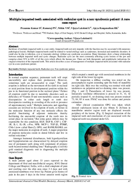 Pdf Multiple Impacted Teeth Associated With Radicular Cyst In A Non