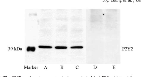 Figure 1 From Atp Activates The Plc Pkc Erk Signaling Pathway Through The P 2 Y 2 Purinergic