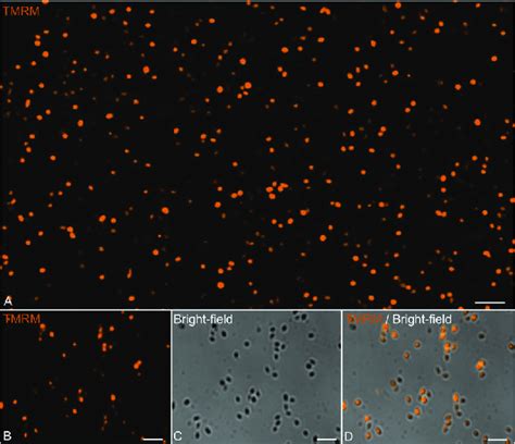 Confocal Imaging Of Tmrm Staining Of Purified P Massiliensis Virions