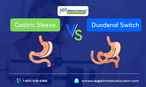 Gastric Sleeve Vs Duodenal Switch Jet Medical Tourism® In Mexico