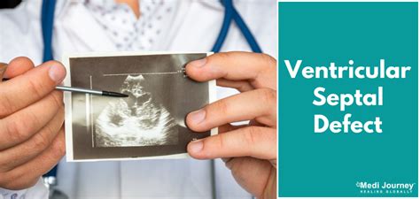 Ventricular Septal Defect Vsd Types Causes And Treatment