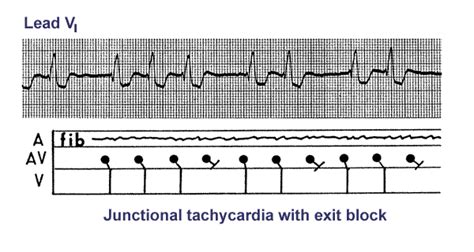 Ecg Learning Center An Introduction To Clinical Electrocardiography