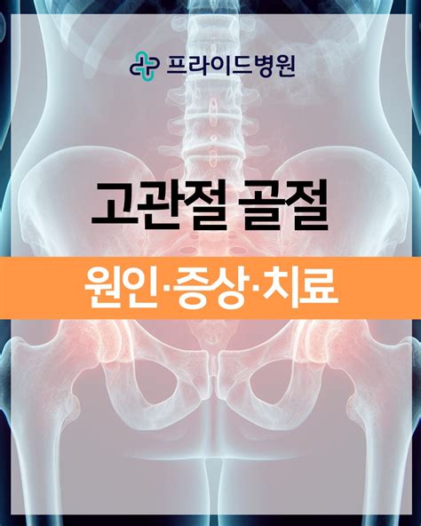 정형외과 프라이드병원🏥 📢어깨 오십견 정형외과에서 치료 방법은 오십견은 어깨 관절의 통증과 운동 제한을 일으키는 질환으로