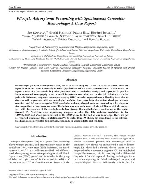 Pdf Pilocytic Astrocytoma Presenting With Spontaneous Cerebellar