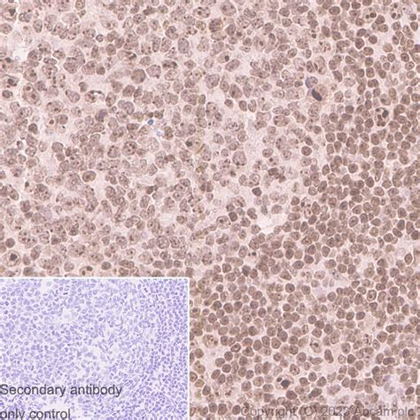 Antigen Retrieval 100x Citrate Buffer Ph 51 55 125 250 Ml