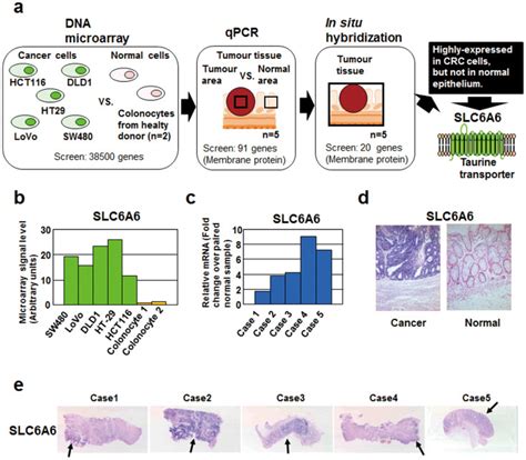 A Schematic Outline Of The Strategy To Identify Crc Specific Genes