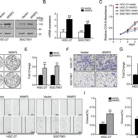 Wwp2 Overexpression Triggers The Proliferation Migration And Invasion