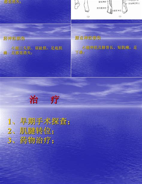 周围神经损伤ppt模板卡卡办公