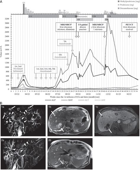 Immune Related Sclerosing Cholangitis And Subsequent Pyogenic Liver Abscesses In Two Patients