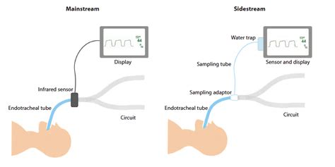 End Tidal Co2 Monitoring