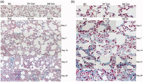 Massons Trichrome Staining Analysis Of Lung Tissues Among Groups Over