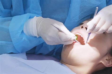 How Do I Choose The Right Dentist For Me Xivents
