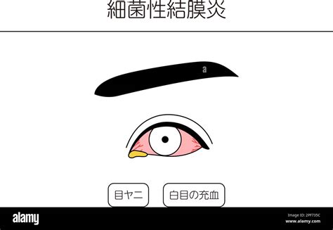 Staphylococcus Epidermidis Bacteria Stock Vektorgrafiken Kaufen Alamy