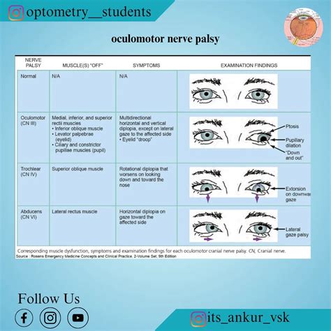 Trochlear Nerve Eye Movement