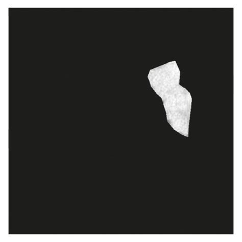 Fcrls Algorithm Automatic Segmentation Steps A Original Image B Download Scientific