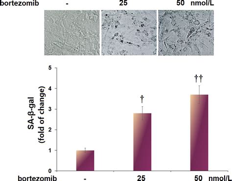Bortezomib Induces Cellular Senescence In A549 Lung Cancer Cells By