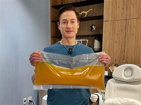 이건 액체 상태의 금” 회춘에 매년 27억 쓰는 억만장자의 혈장교환술 후기