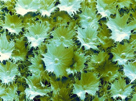 Shield Like Hairs On Elaeagnus Leaf Stock Image B7450338 Science