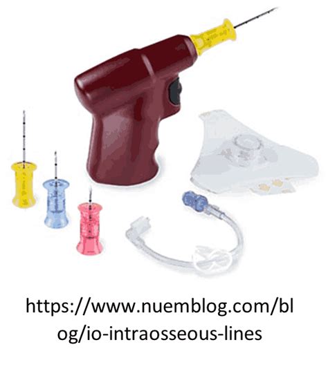 Intraosseous Infusion Io