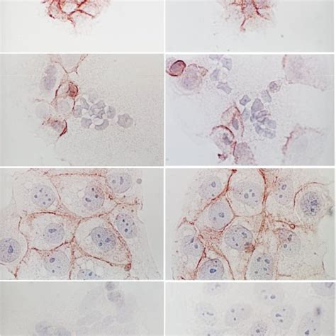 Immunolocalization Of E Cadherin E Cad And β Catenin In Villous