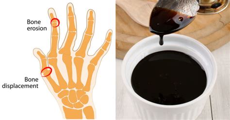 Blackstrap Molasses 9 Health Benefits David Avocado Wolfe