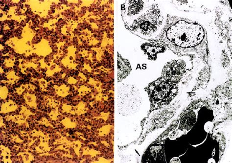 A Light Micrograph Hematoxyline Eosin Staining Magnification X 160