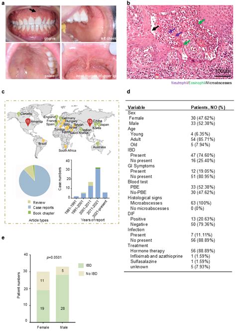 Pyodermatitis Pyostomatitis Vegetans The Role Of Langerin Deficiency In Disease Pathogenesis