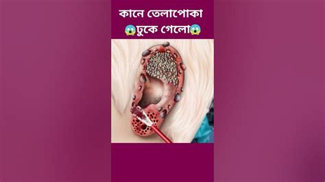 কানে তেলাপোকা ঢুকে কানে একি হলো Cartoon 3danimation Youtube