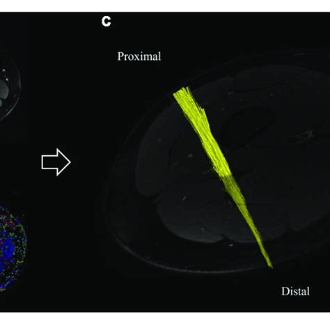 Automated Segmentation Of The Sciatic Nerve Based On Download