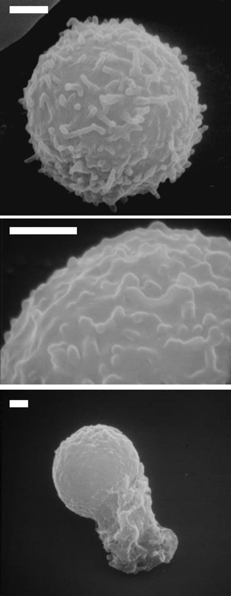 Scanning Electron Micrographs Of Human Leukocytes The Surfaces Of Human